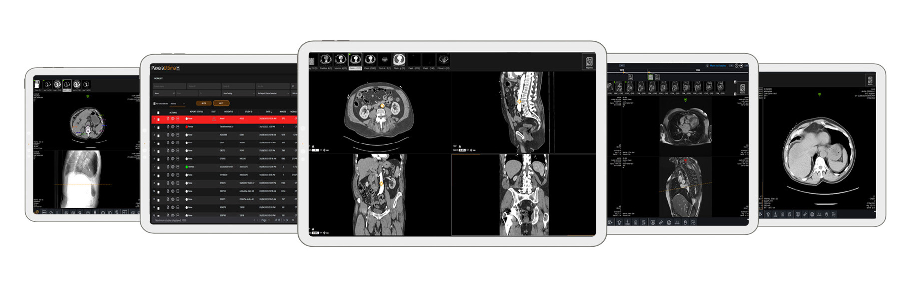 PaxeraUltima – Advancemed Solution